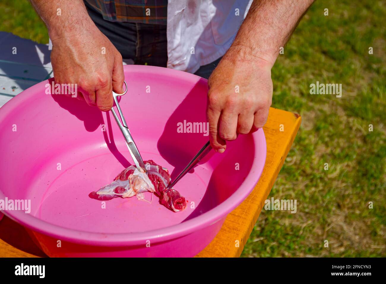 Trichinosis hi-res stock photography and images - Alamy
