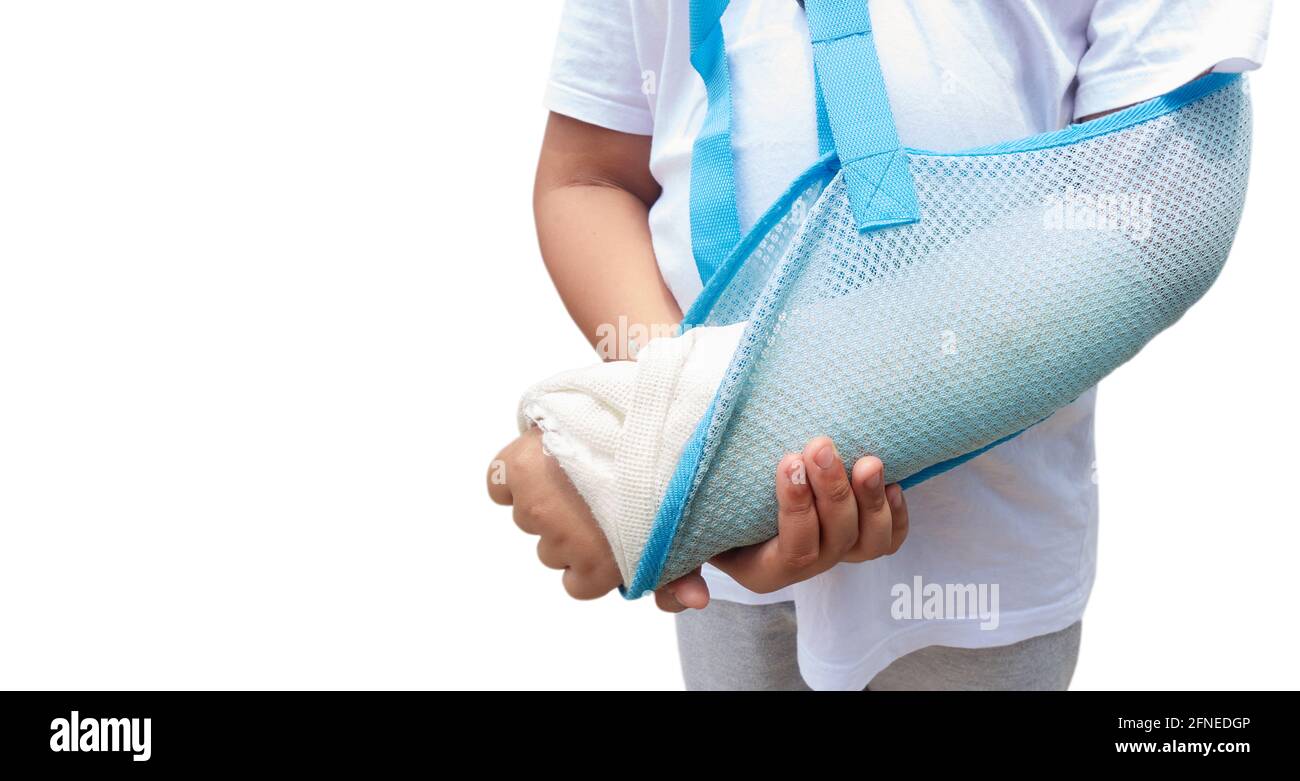 Child with a broken arm after accident Stock Photo - Alamy