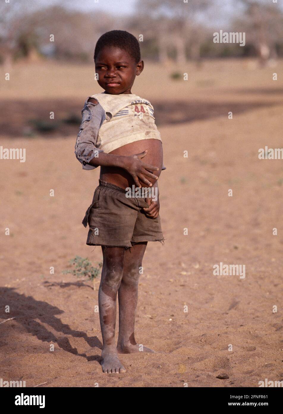 MOZ, Mozambique : A boy during the drought in Gaza province , August 1992 |MOZ, Mozambique : A ...