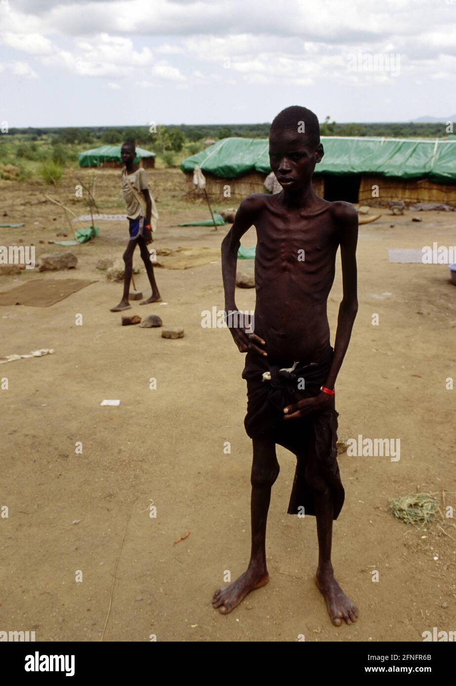 SDN , SUDAN : A starving young man in Lafon ( South Sudan ) , August ...