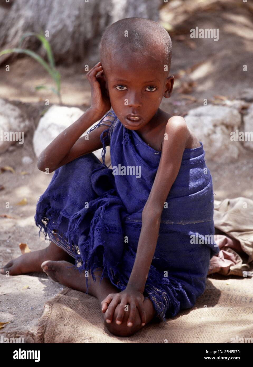 SOM , SOMALIA : A boy in a feeding centre in Mogadishu , April 1992 ...
