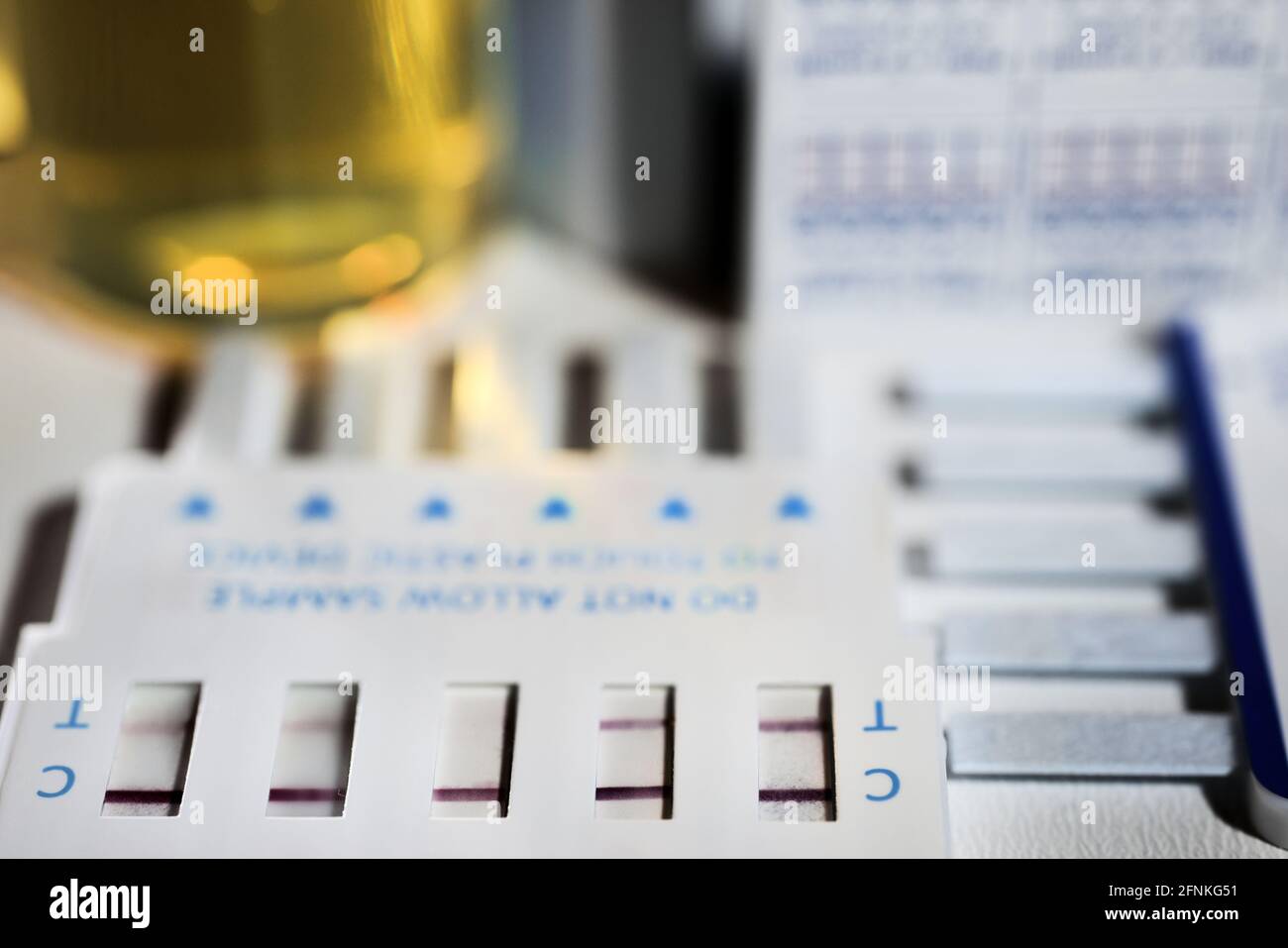 Positive urine drug test screening check for drugs Stock Photo - Alamy