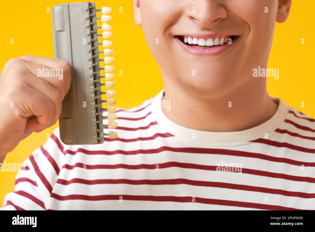 Young man with teeth color chart on yellow background Stock Photo - Alamy