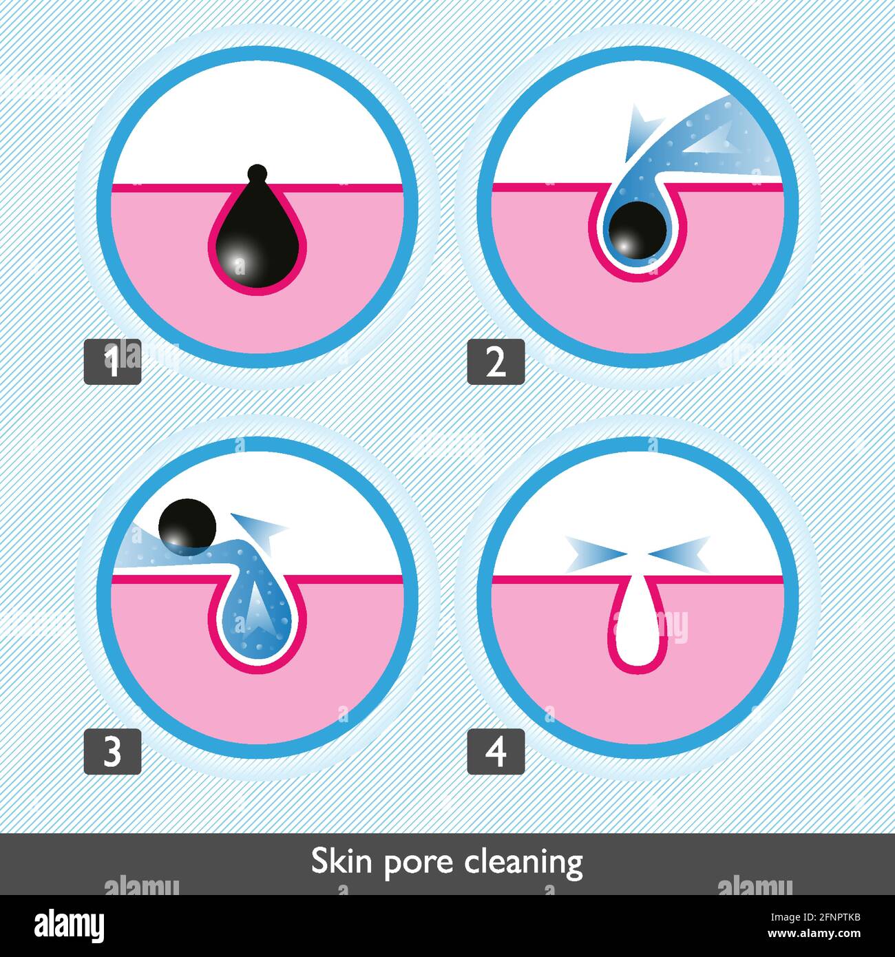 Skin pore cleansing process icons. Facial treatments colored icons ...