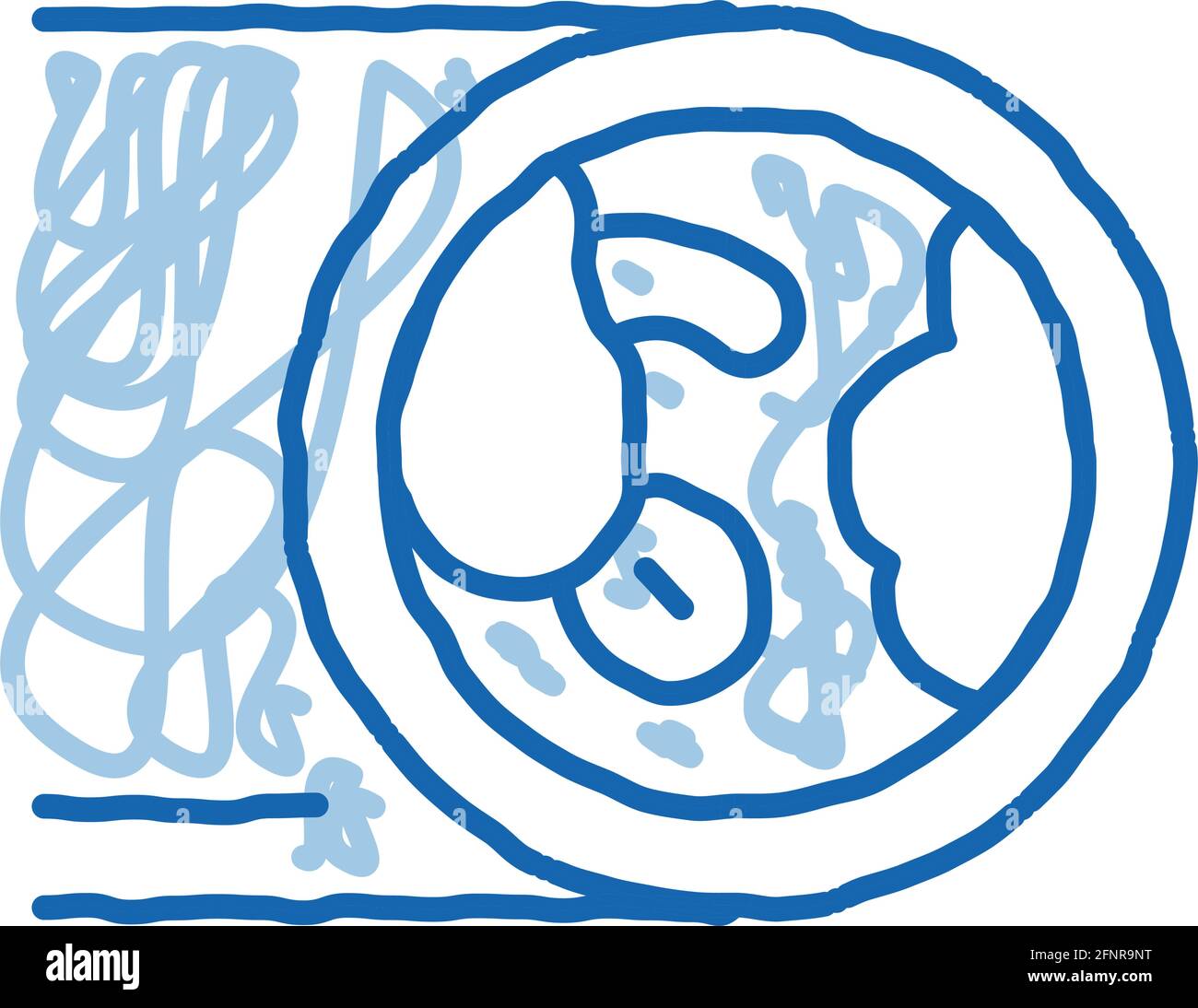 Cholesterol artery blockage Stock Vector Images - Alamy