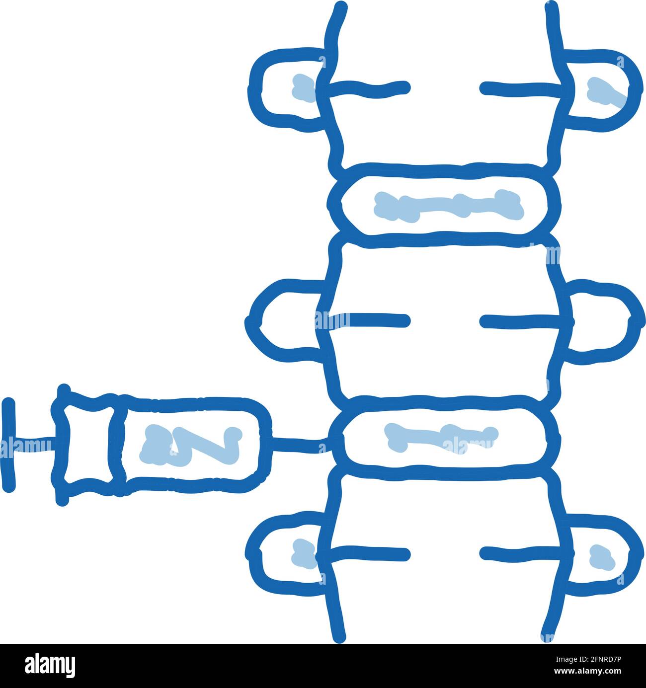 epidural spinal anesthesia doodle icon hand drawn illustration Stock ...