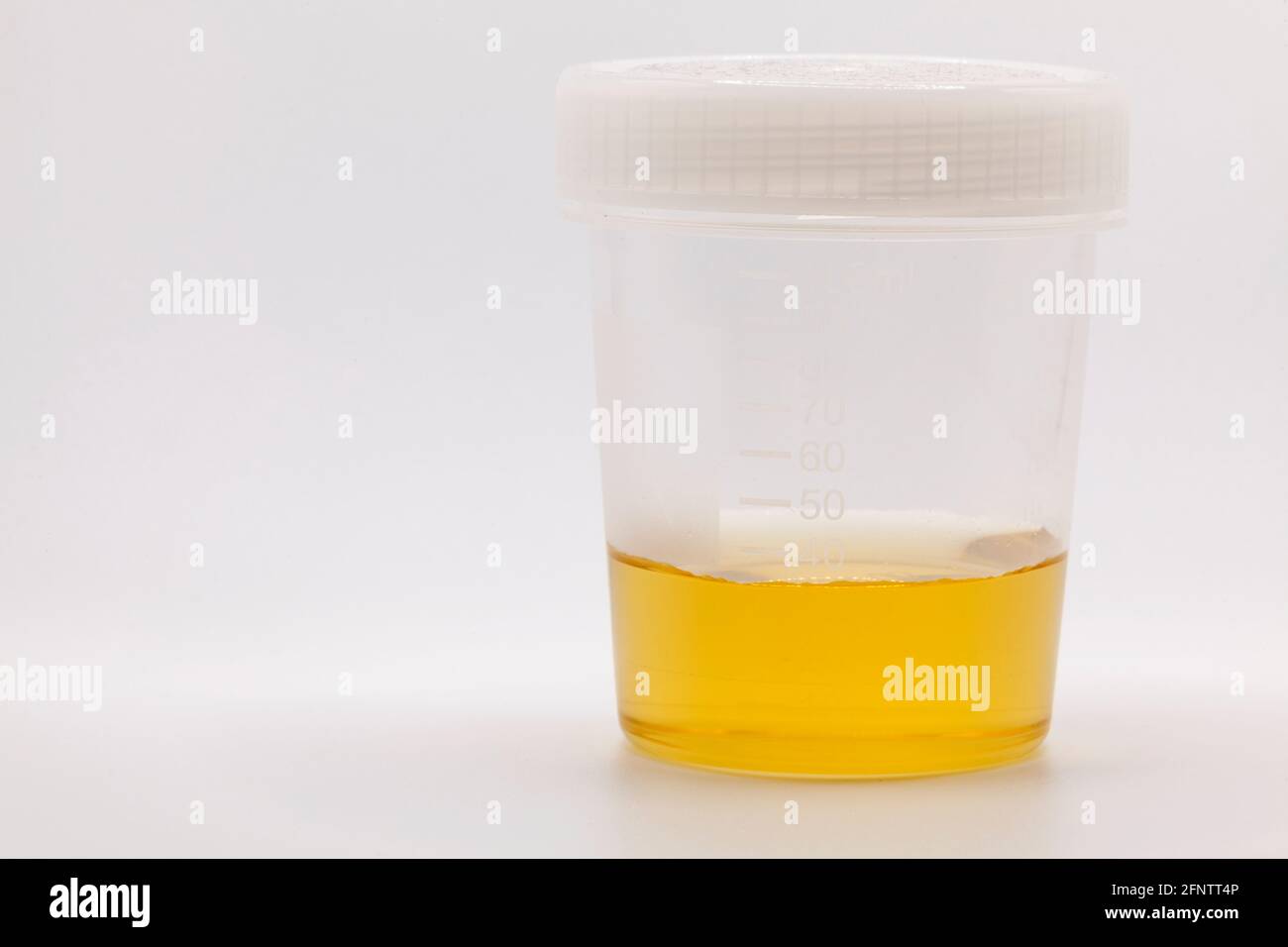 canned urine sample on white background Stock Photo - Alamy