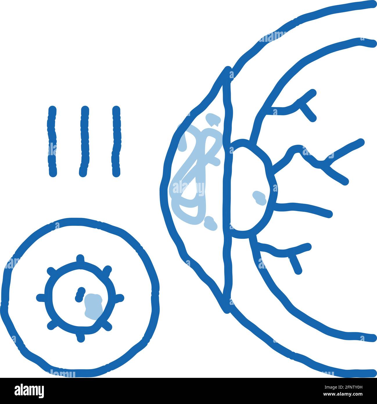 visual impairment doodle icon hand drawn illustration Stock Vector ...