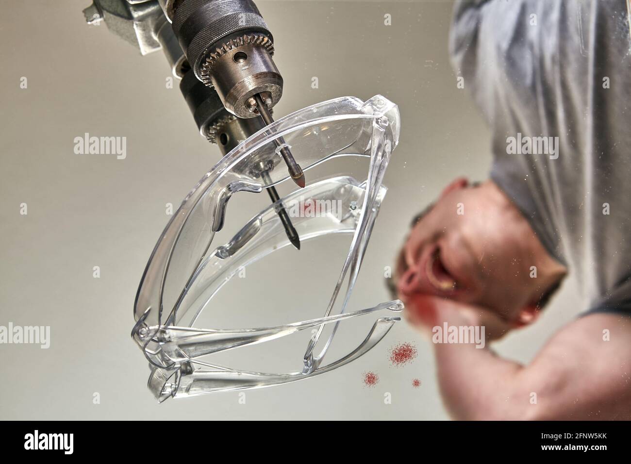 Safety Glasses Injury Pictures at Pam Calhoun blog