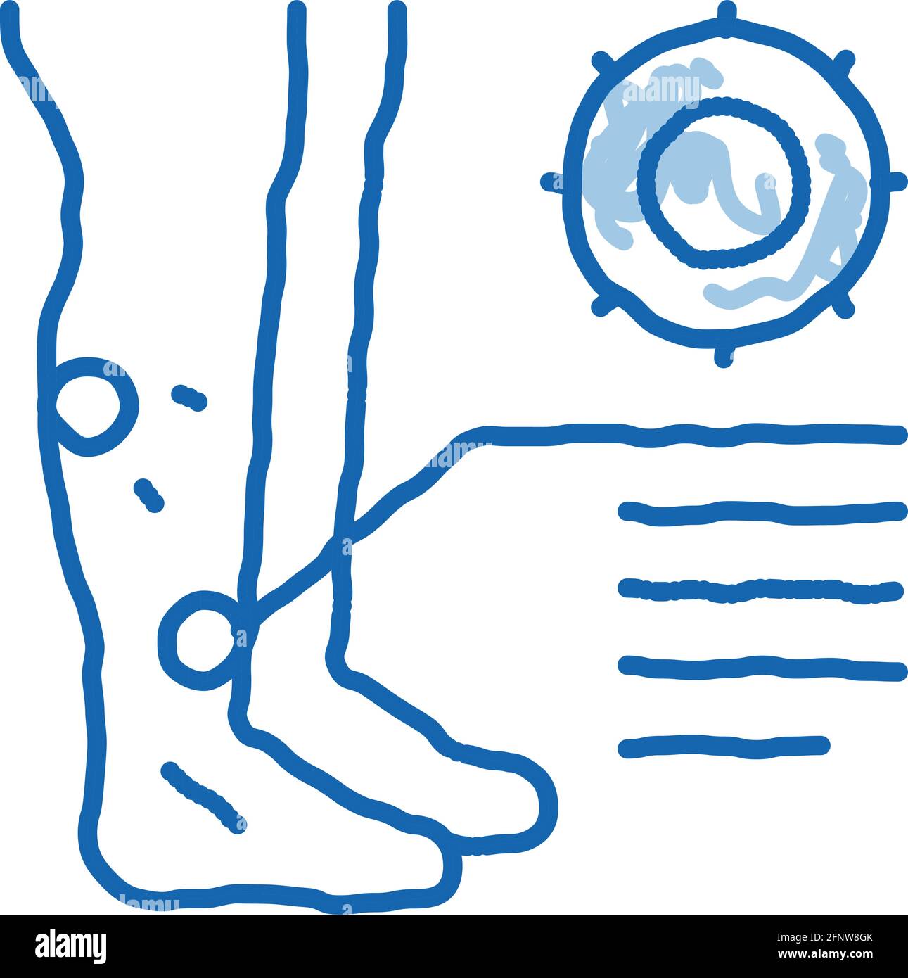 rash dermatitis on legs doodle icon hand drawn illustration Stock ...