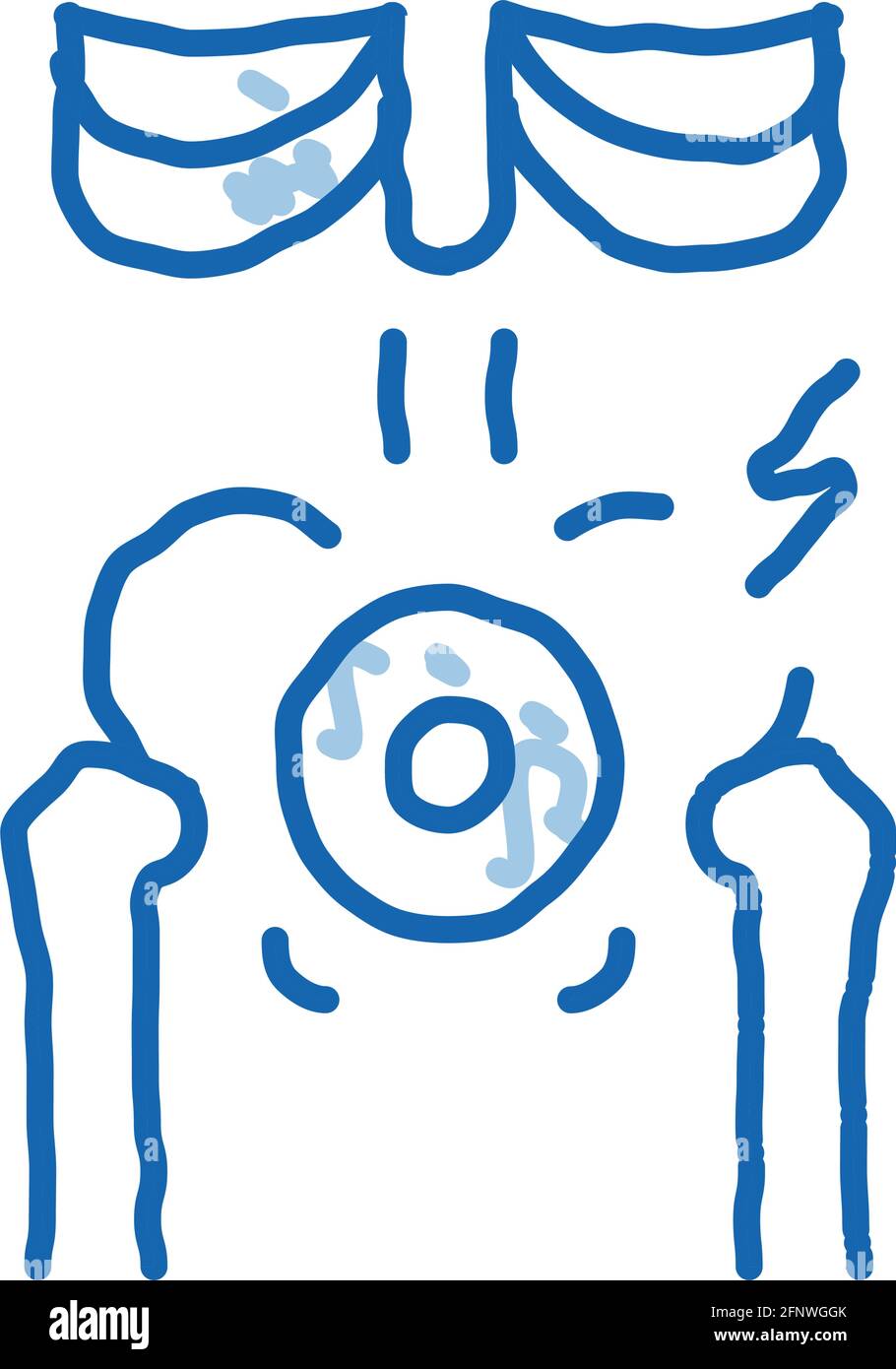 hip arthritis doodle icon hand drawn illustration Stock Vector Image ...