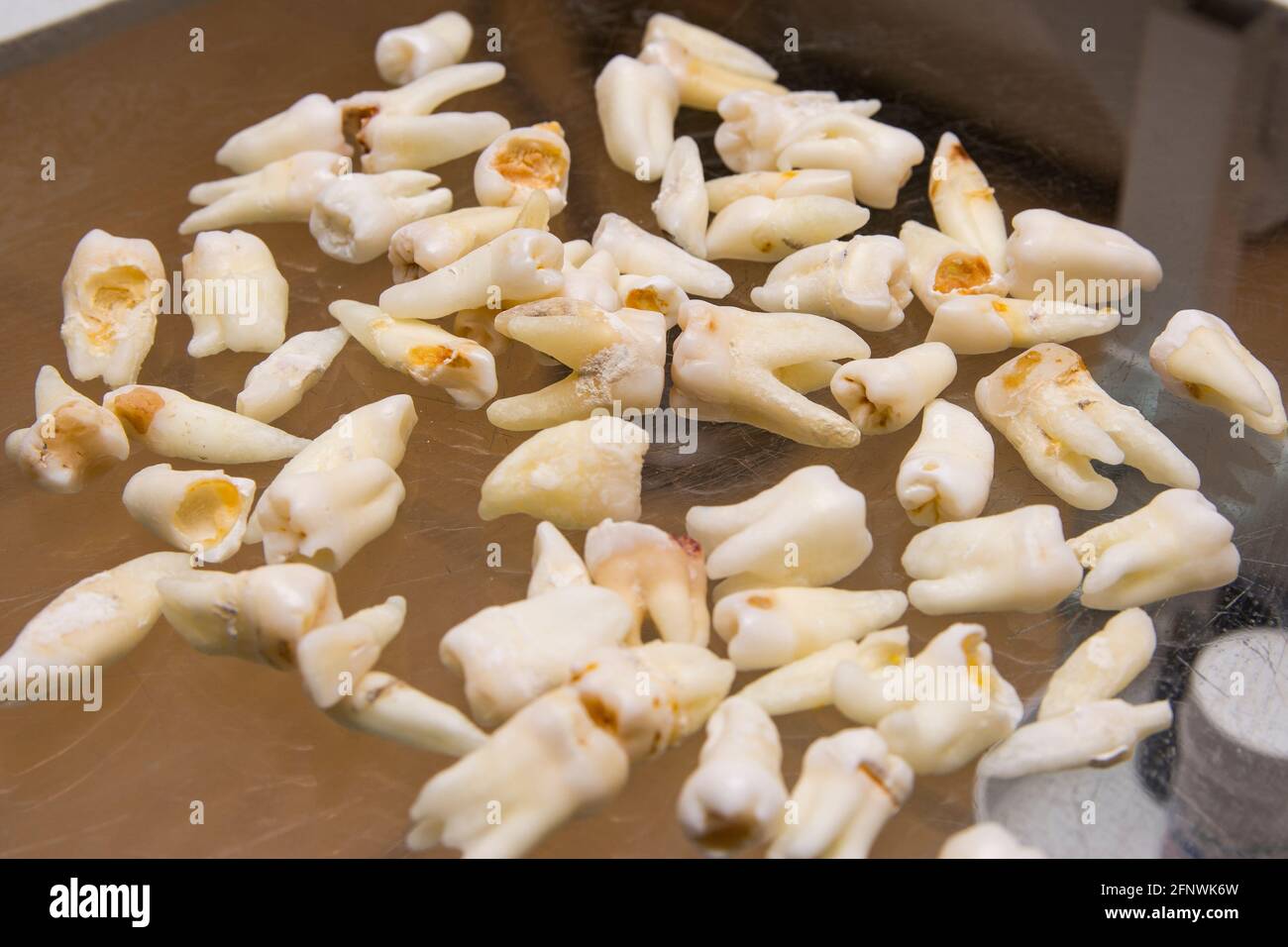 Mottled teeth hi-res stock photography and images - Alamy