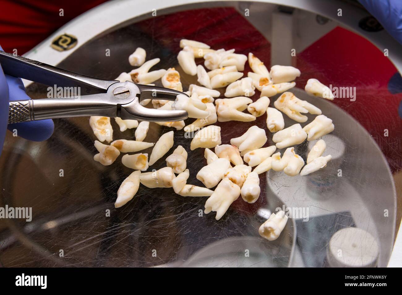 Pulled tooth in the metallic forceps and little blood on tooth. Dentist ...