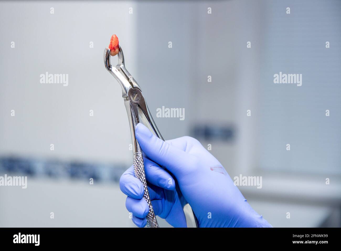 Pulled tooth in the metallic forceps and little blood on tooth. Dentist ...