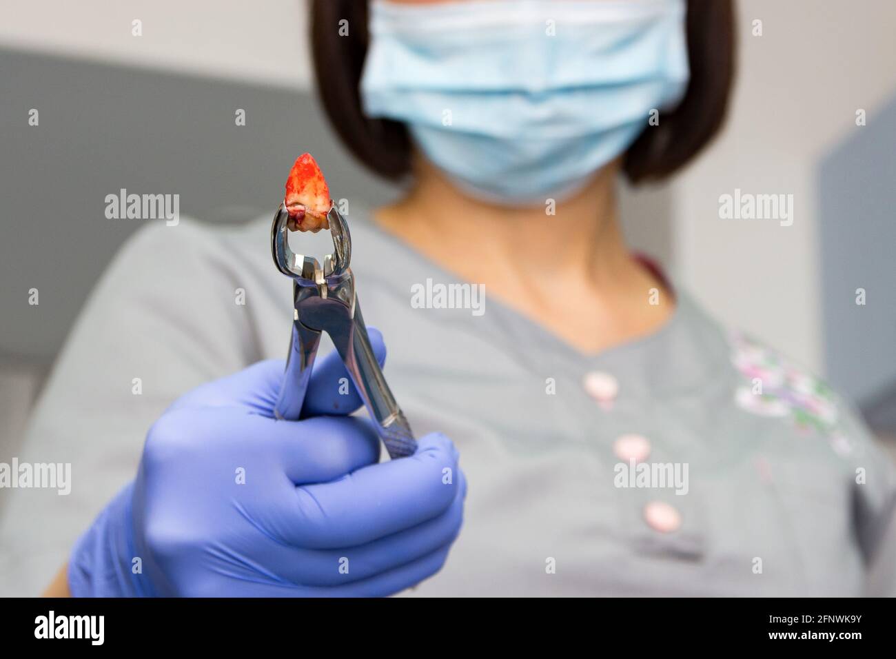 Pulled tooth in the metallic forceps and little blood on tooth. Dentist ...