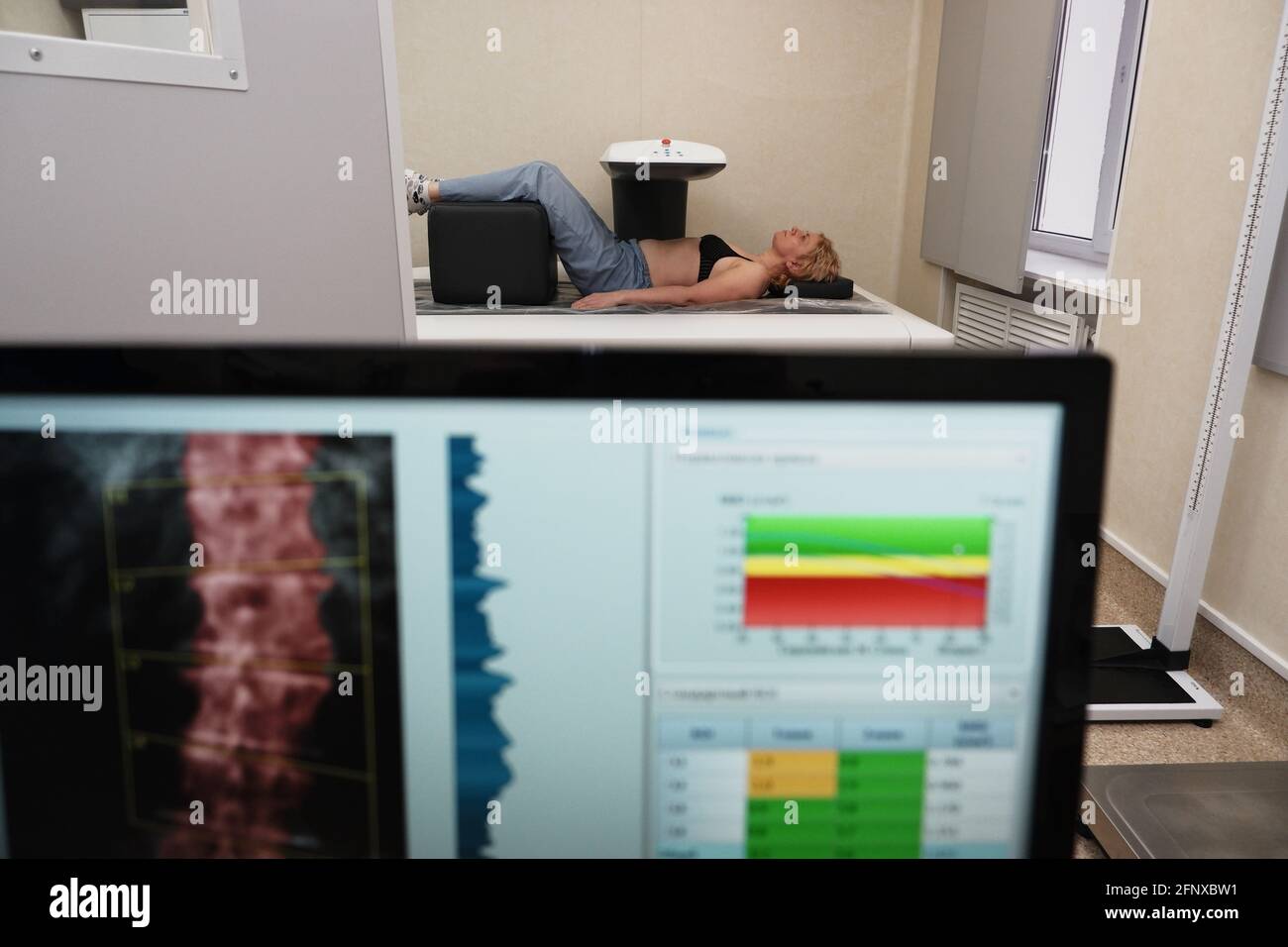 Investigation of the density of human bones using an osteodensitometry ...