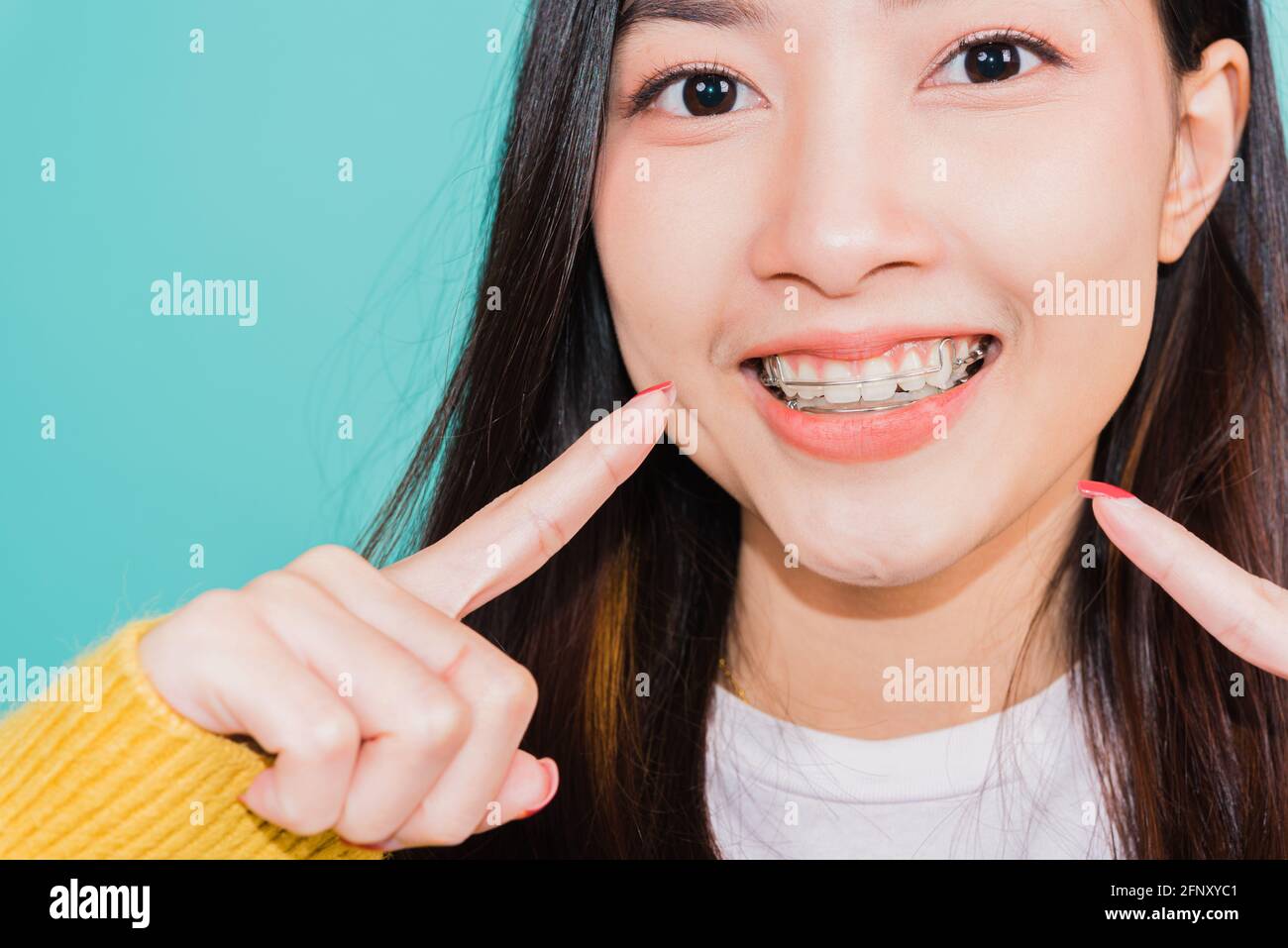 Asian beautiful young woman teen pointing finger to teeth, portrait of ...