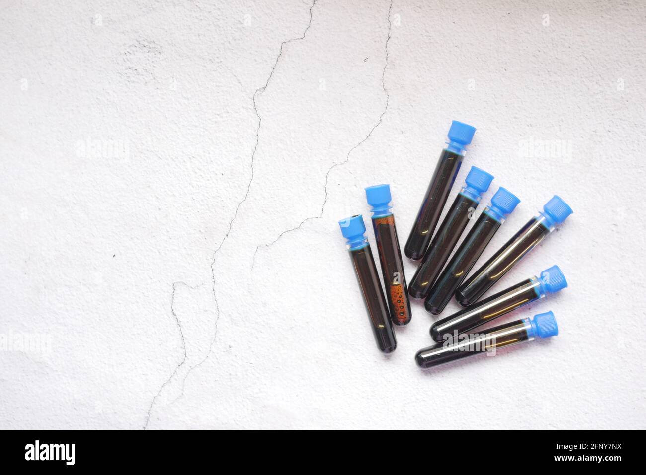 Top view of blood test tube and laboratory equipment on table Stock ...