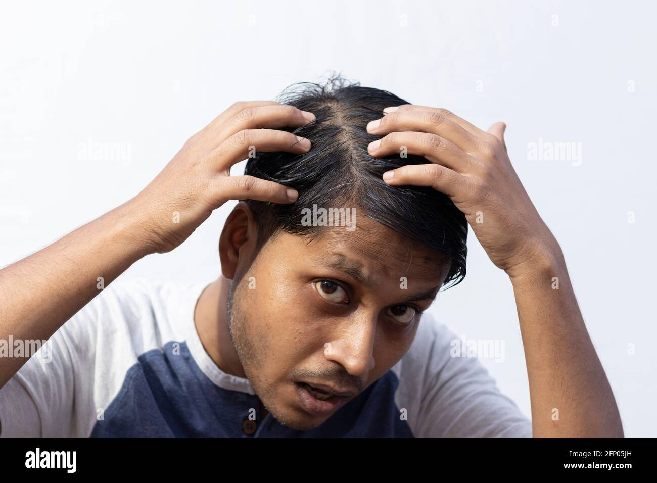 A middle aged Indian man is looking at his hair fall with surprised ...
