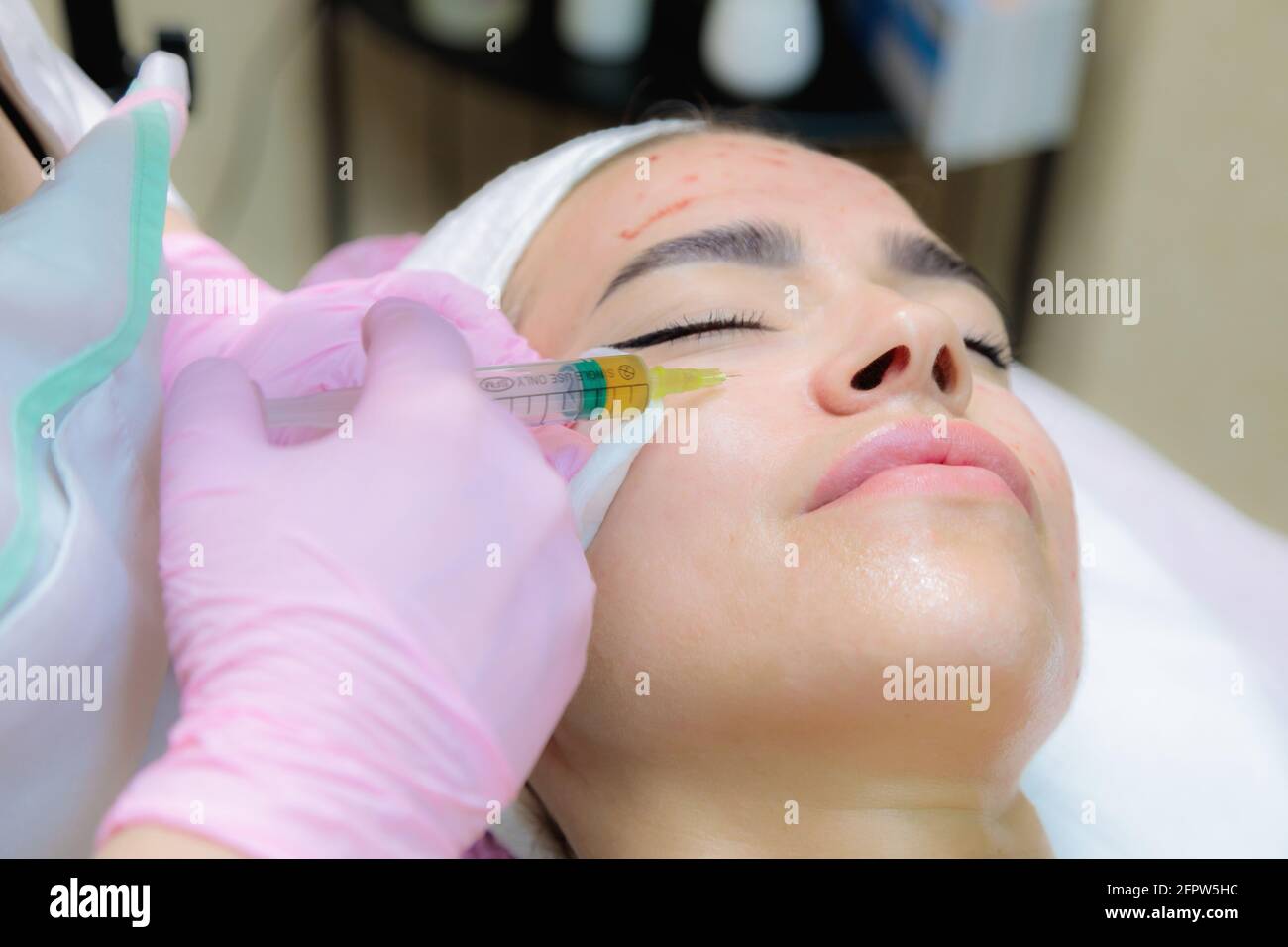 The doctor gives injections of blood plasma into the face of a young ...