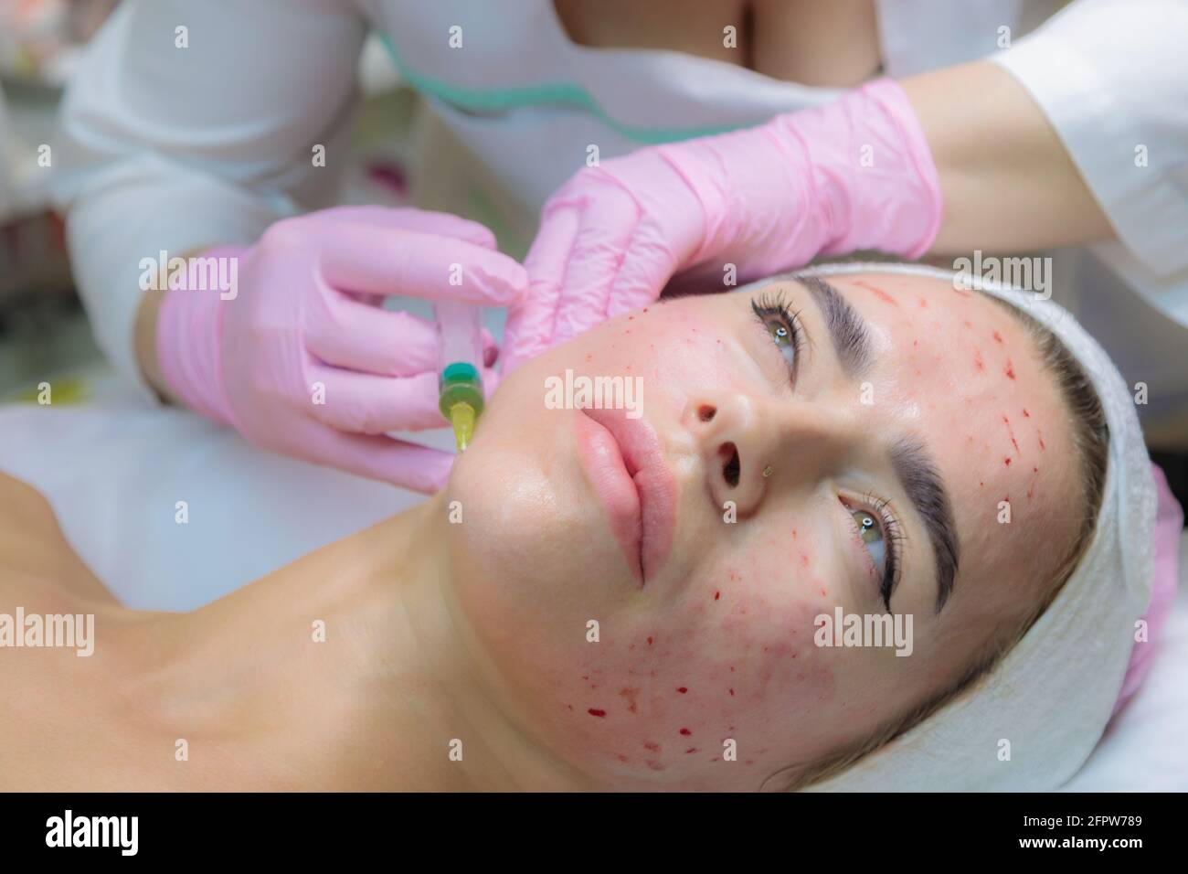 The doctor gives injections of blood plasma into the face of a young ...