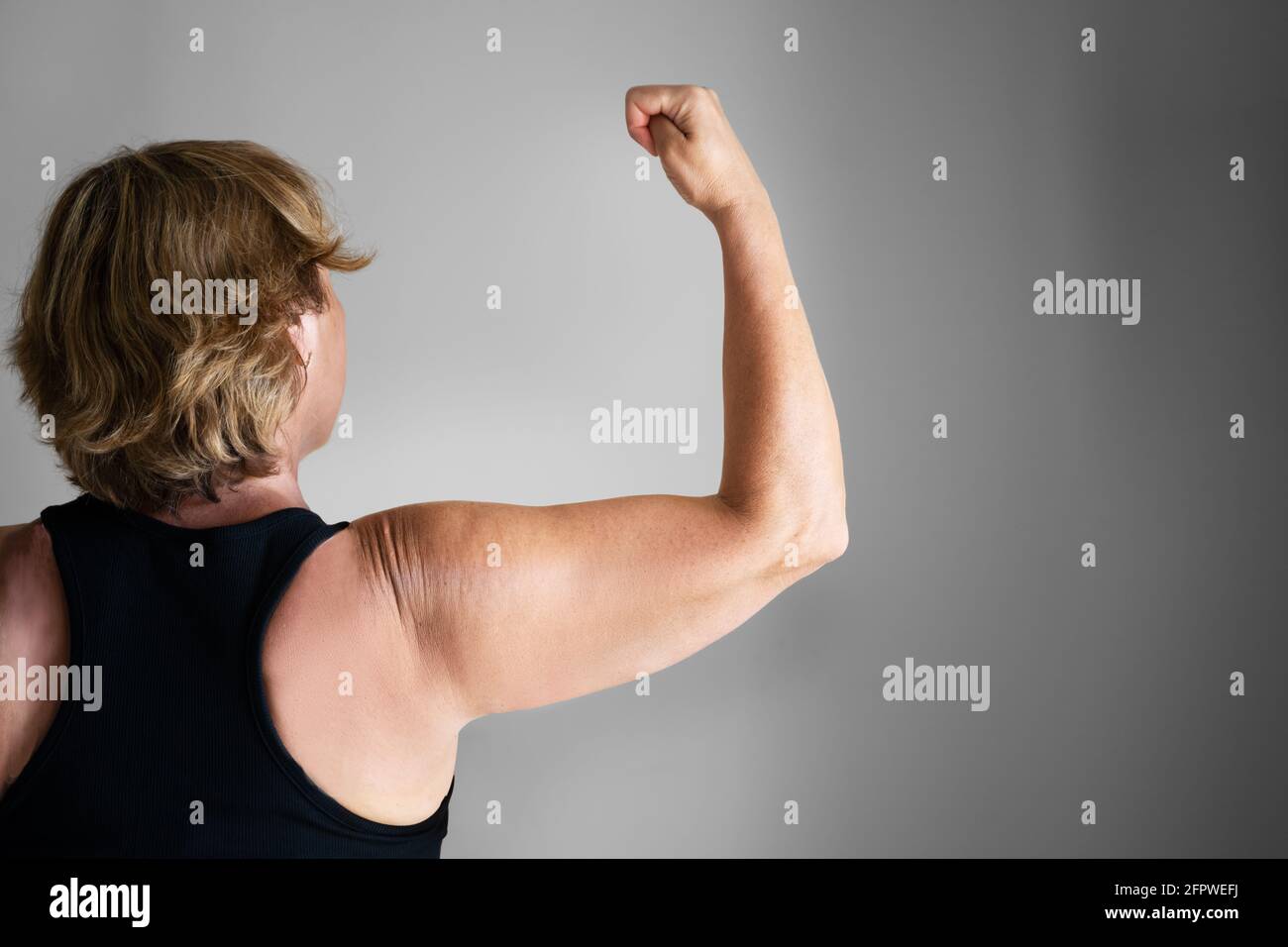 Overweight Lady Arm With Excess Fat. People Obesity Stock Photo - Alamy