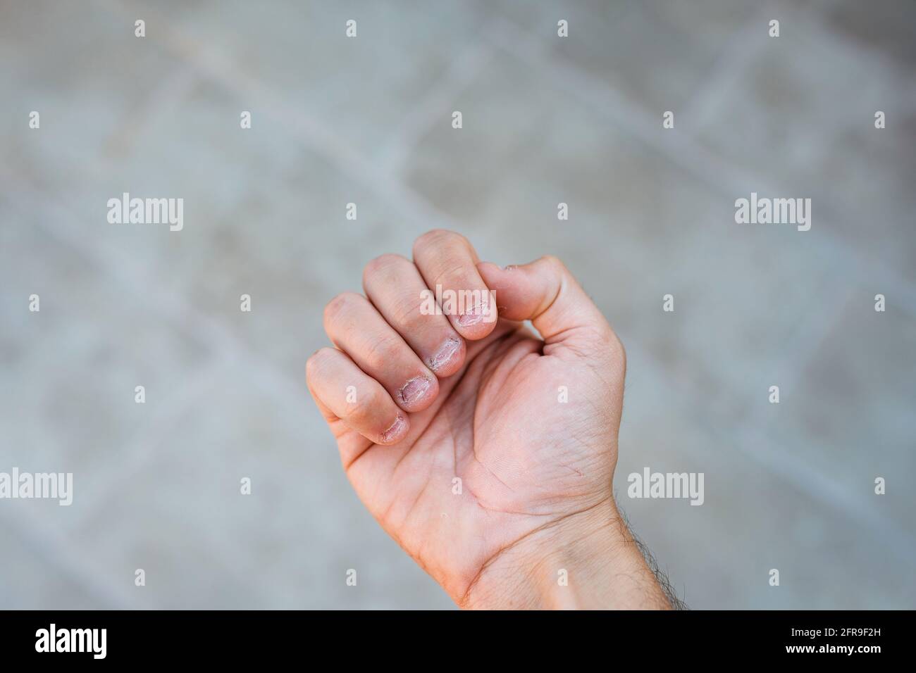 A man's hand with bitten and ugly fingernails. Bad care of hands Stock ...