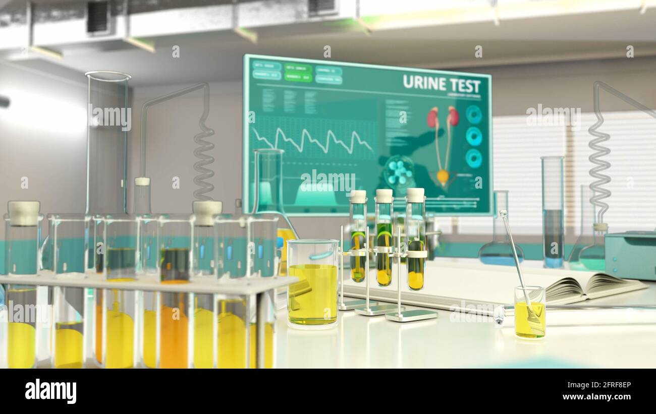 cg medical 3d illustration, laboratory urine gene test backdrop Stock ...