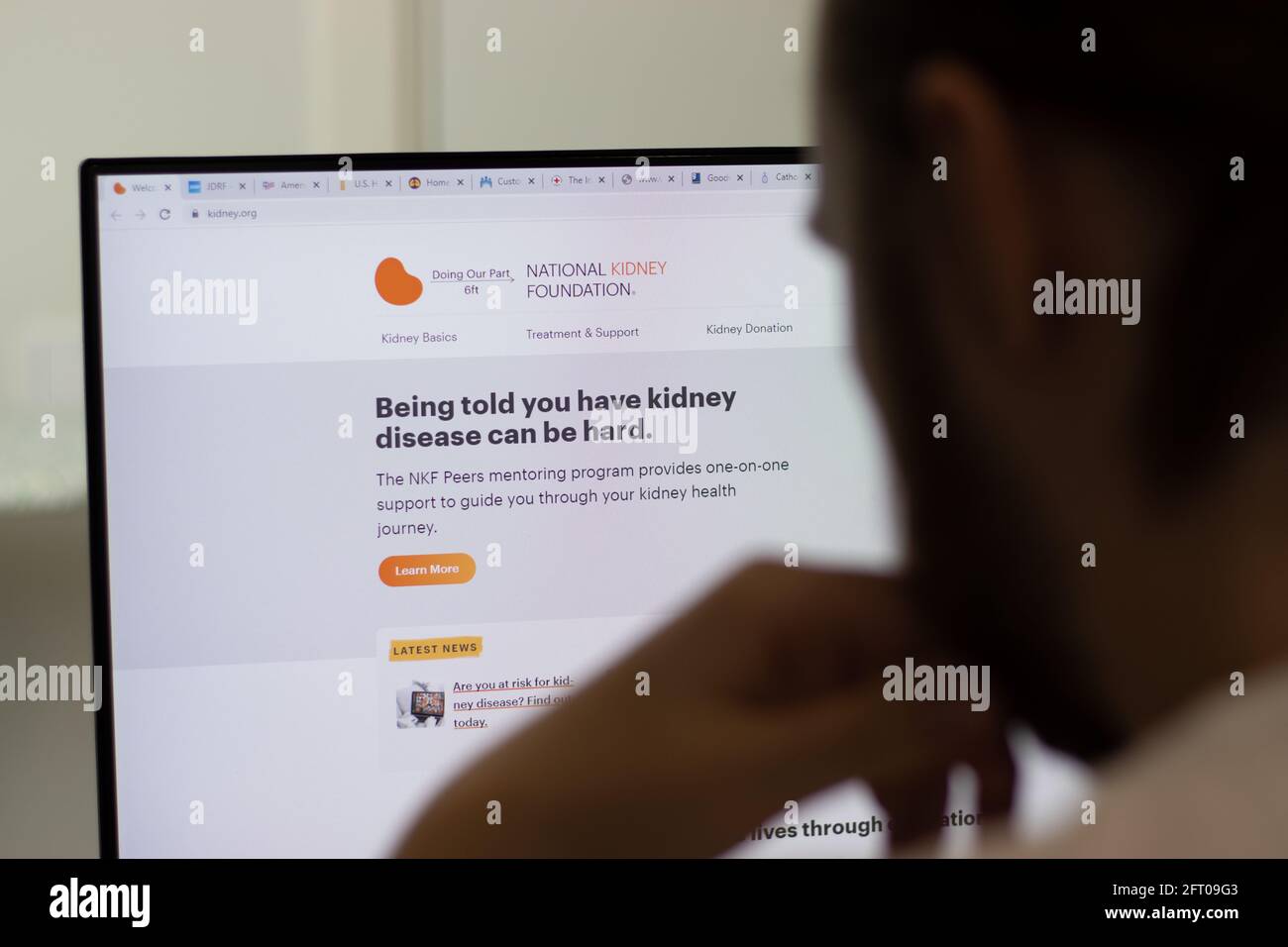 New York, USA - 1 May 2021: National Kidney Foundation company website ...