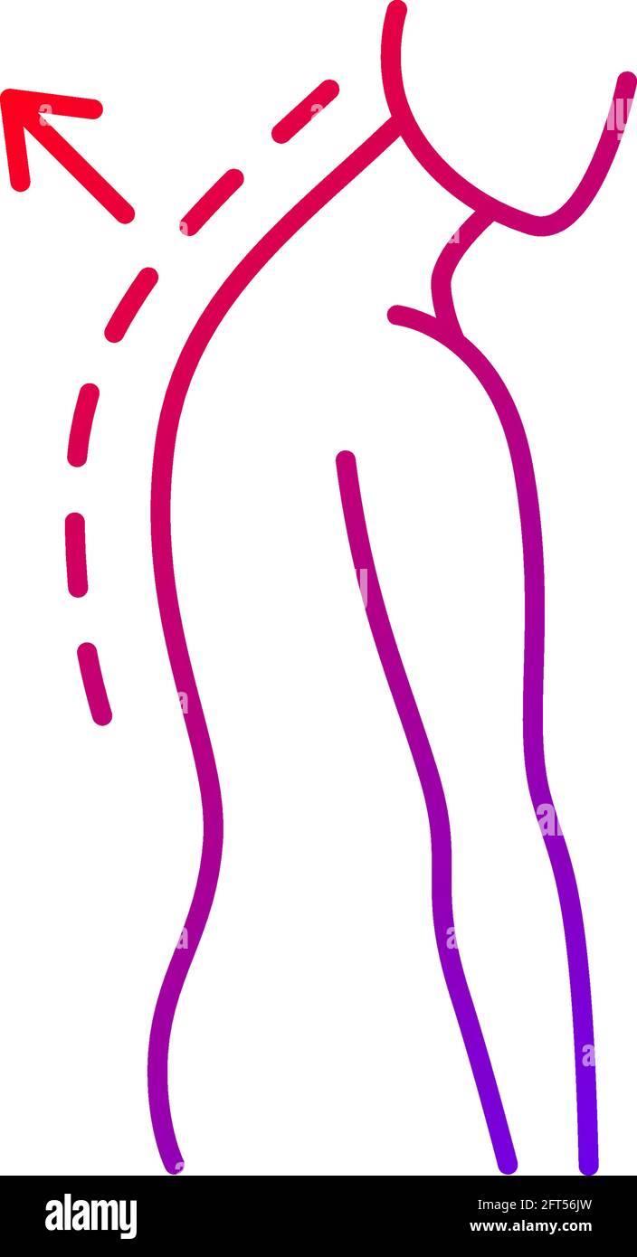 Thoracic kyphosis gradient linear vector icon. Prominent shoulder blade ...