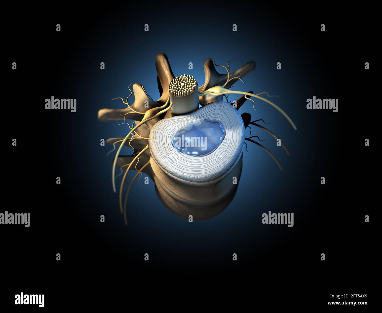 3D illustration showing lumbar vertebra with intervertebral disc and nucleus pulposus Stock ...