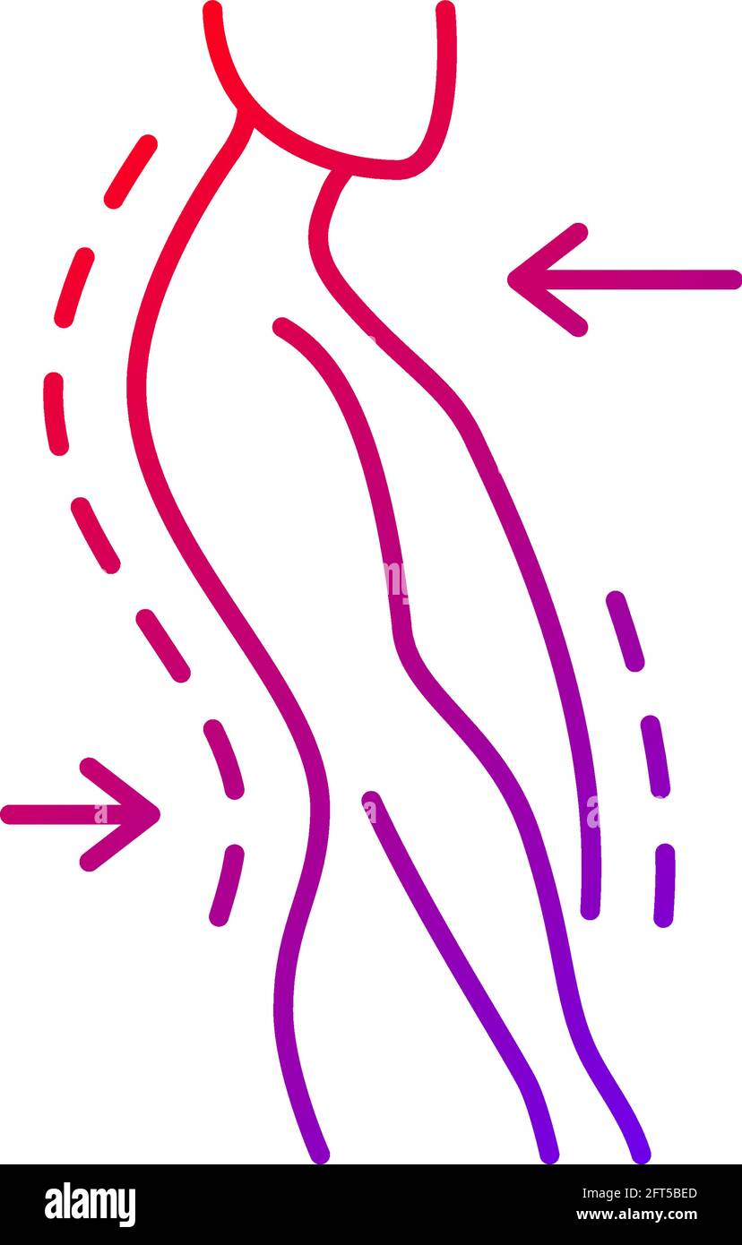 Swayback posture gradient linear vector icon. Spine curvature disorder ...