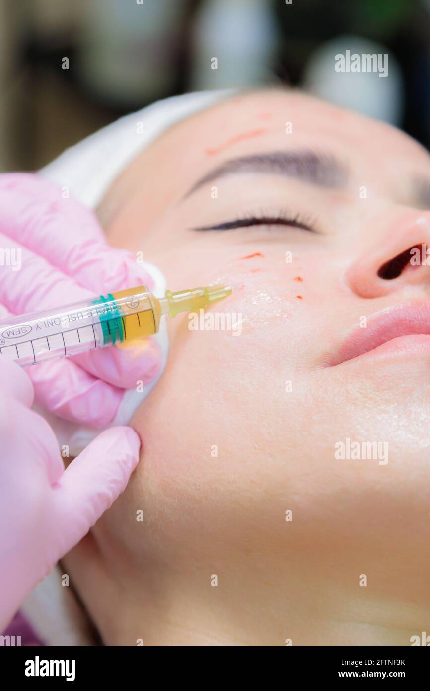 The doctor gives injections of blood plasma into the face of a young ...