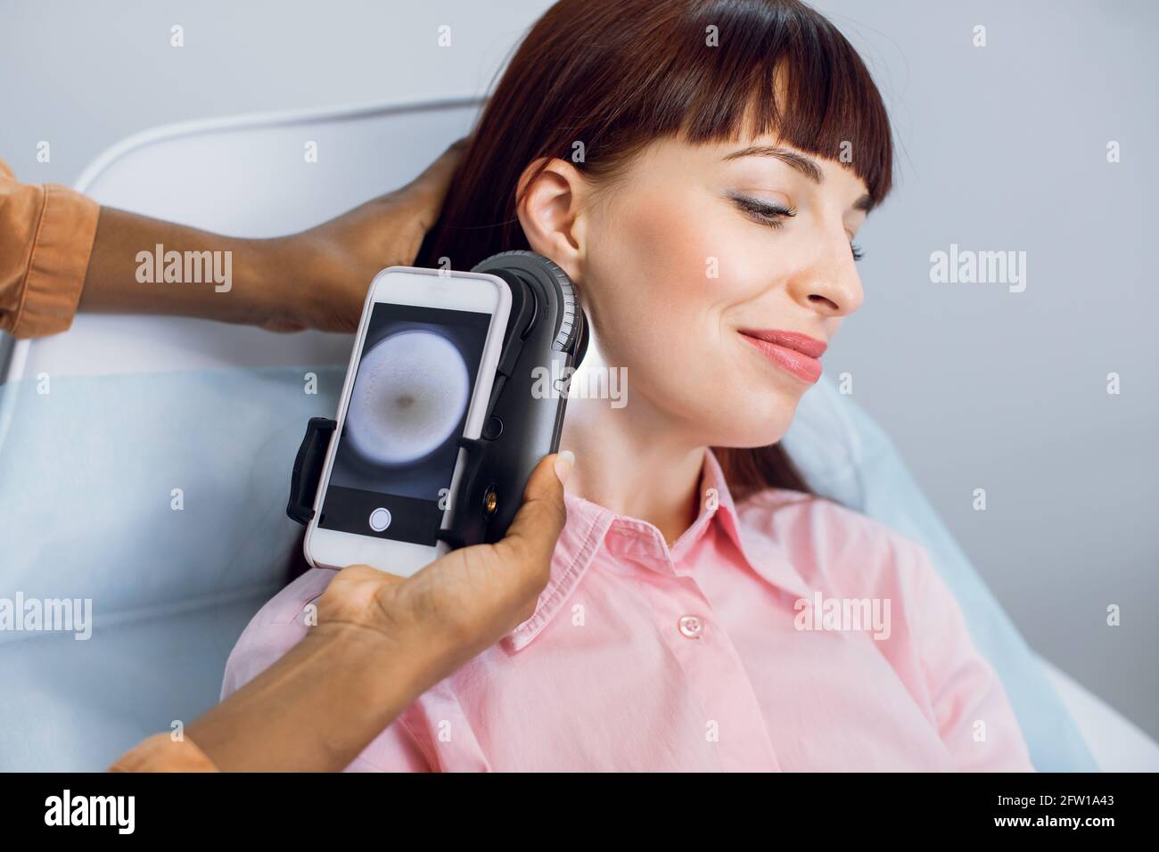 Mole checkup. Professional dermatoscopy. Close-up of dermatologist ...