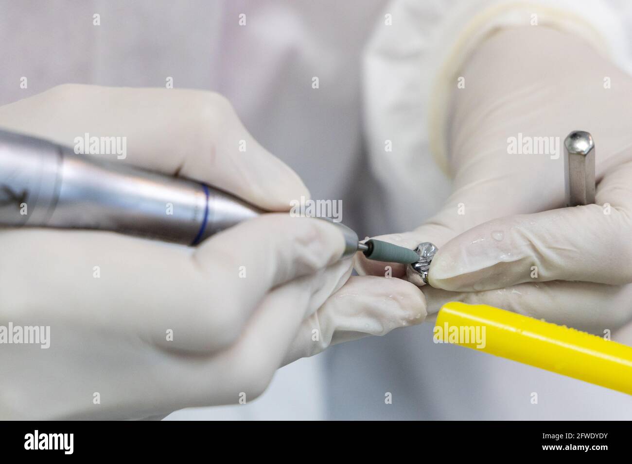 Dental crown fitting hi-res stock photography and images - Alamy