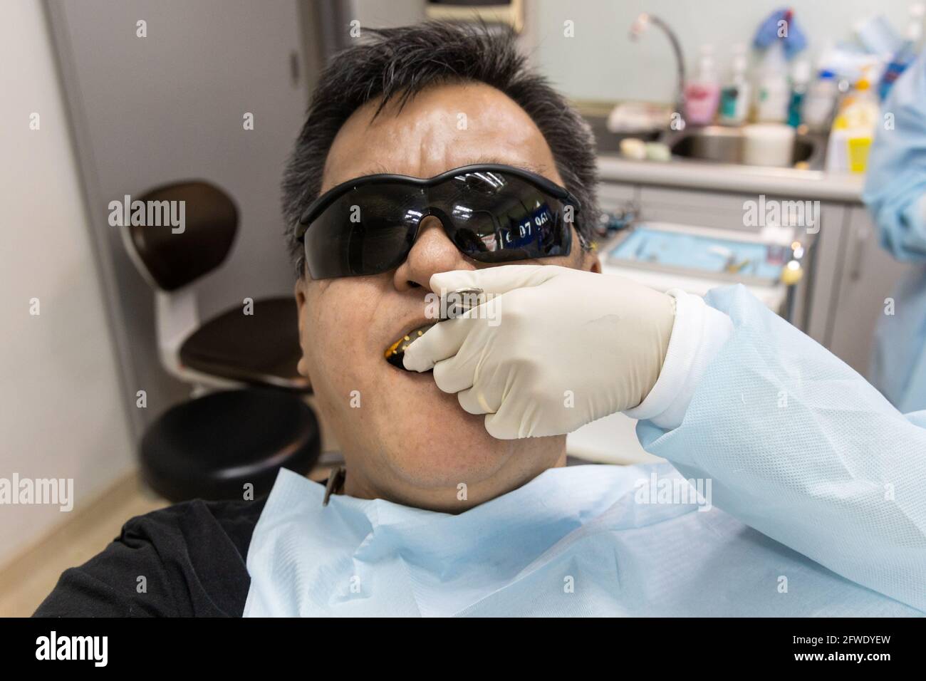 Dentist taking teeth imprint or impression of patient in dental clinic ...