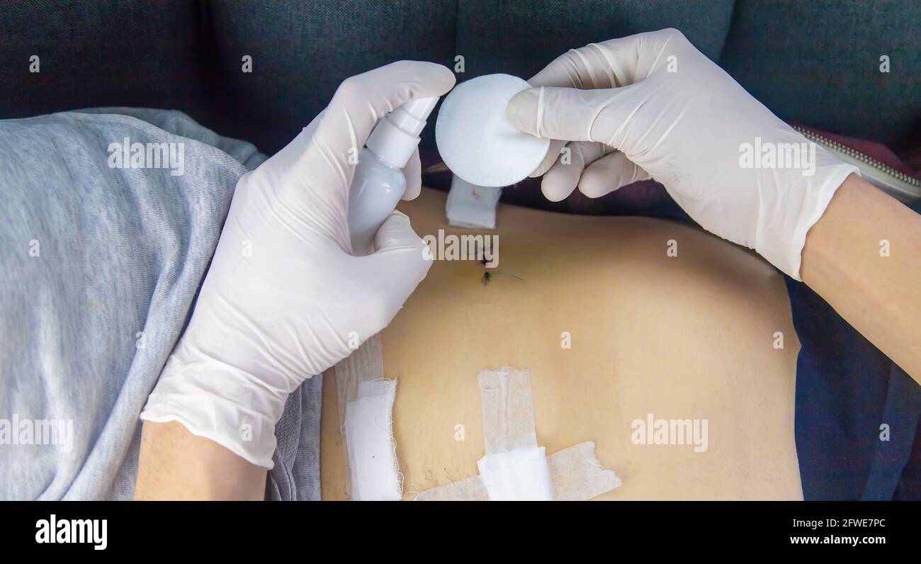 Examination of the patient by a doctor after removal of the appendix ...