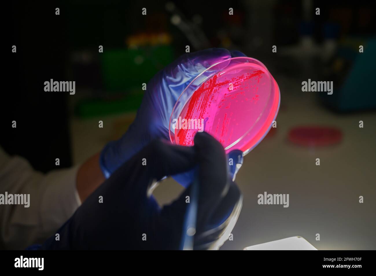 Woman Reasercher picking up colony of a red bacterial culture from pink ...