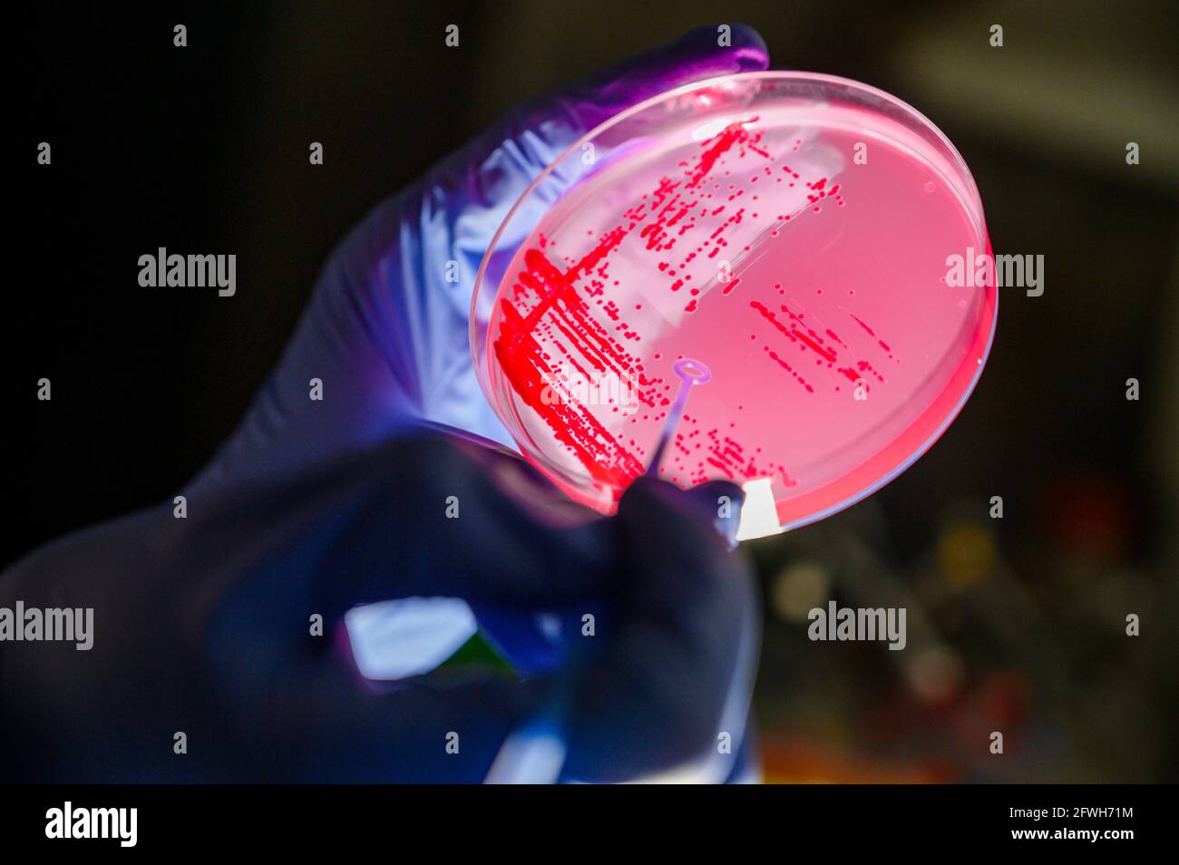 Reasercher picking up colony of a red bacterial culture from pink ...