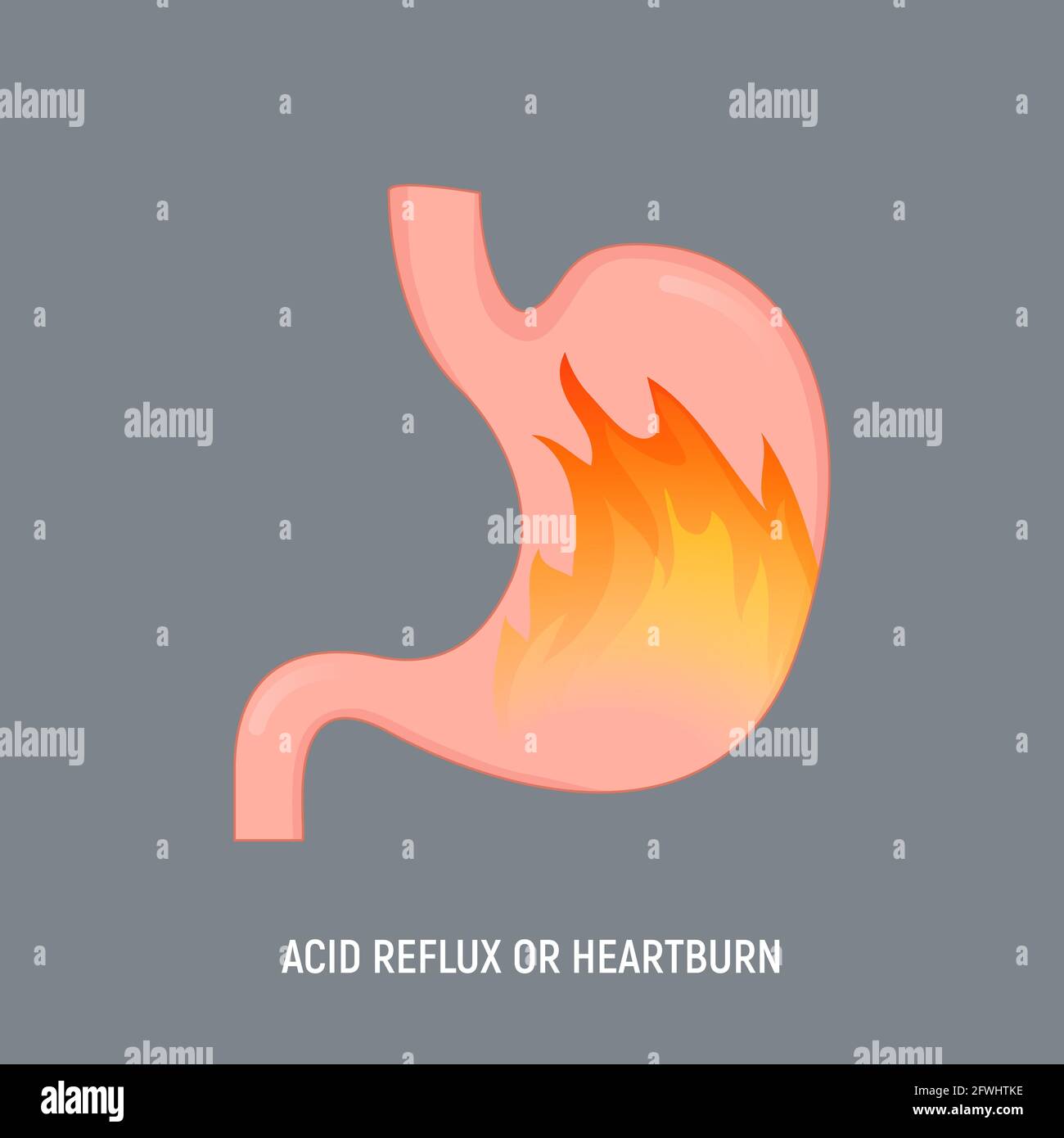 Acid stomach burn gastritis icon. GERD acidity stomach reflux heartburn ...