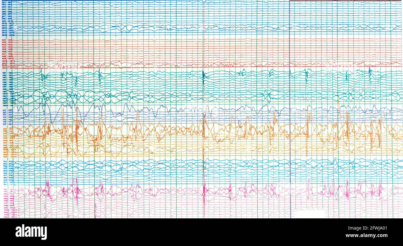 Eeg waves hi-res stock photography and images - Alamy