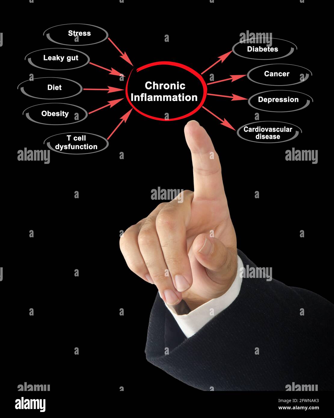 Presenting Causes of Chronic Inflammation Stock Photo - Alamy