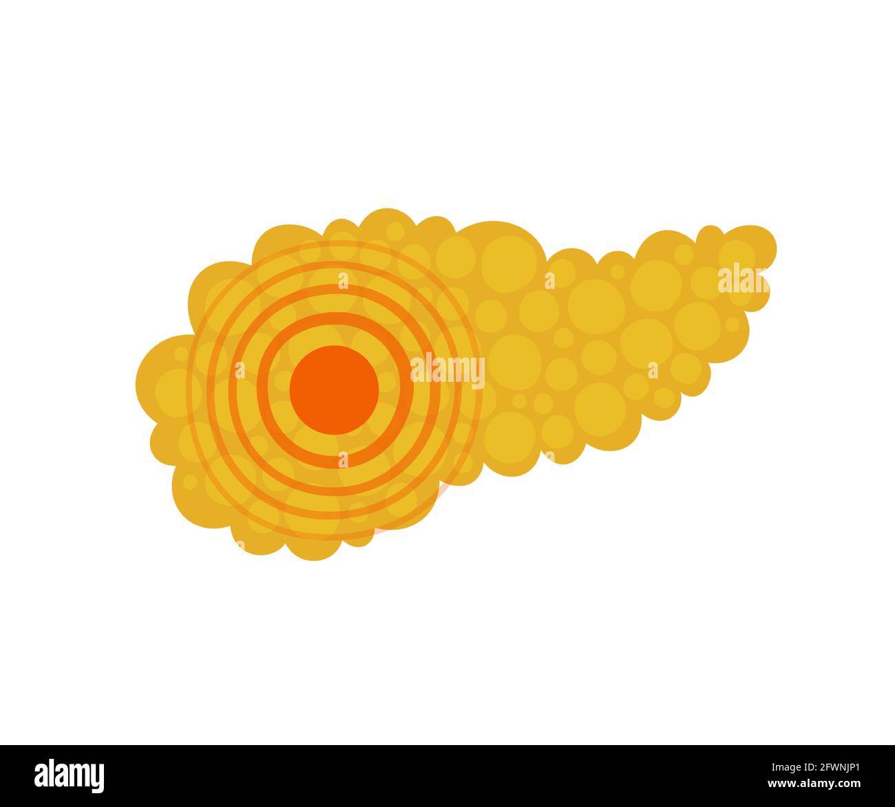 Pain in the pancreas. Sick pancreas. Pancreatitis attack. Isolated ...
