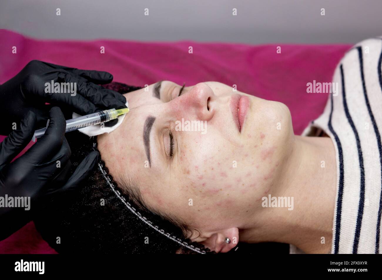 Face mesotherapy procedure in a beauty salon. Beautician doctor makes ...