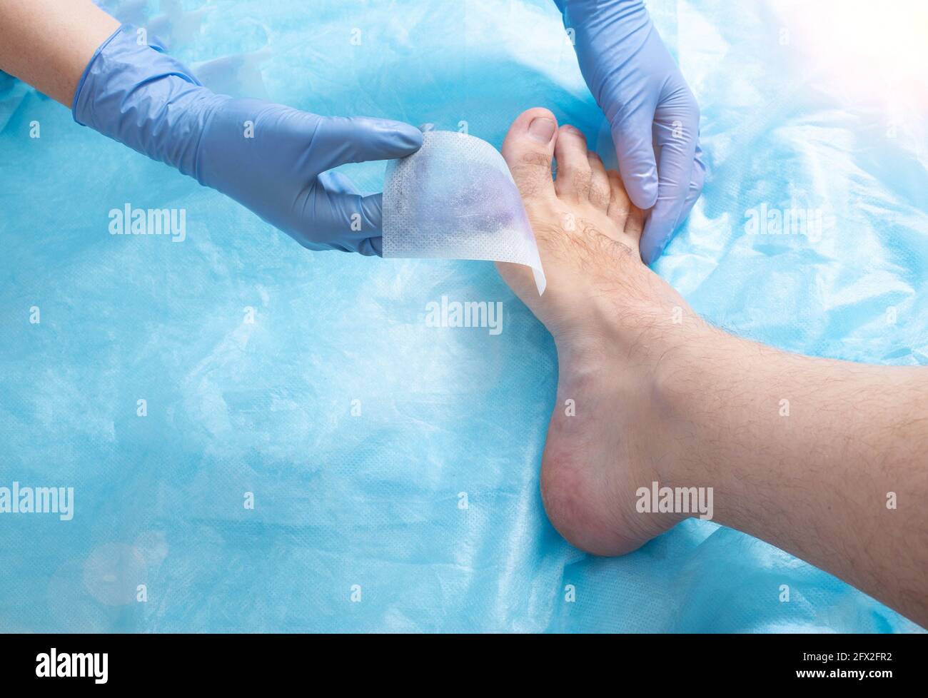 Doctor cosmetologist removes wax strip from patient's leg for hair ...