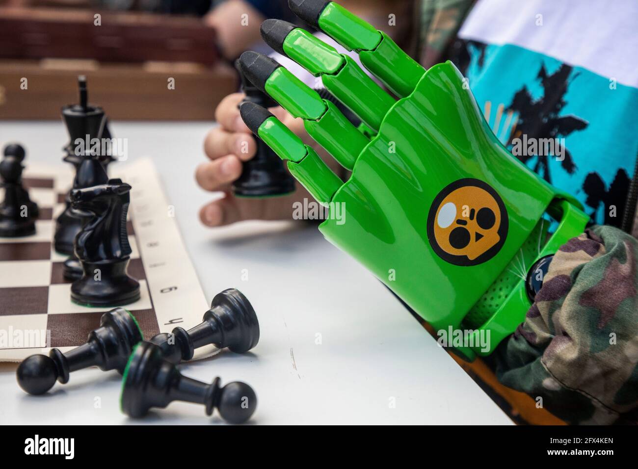 A boy with a bionic prosthetic arm plays chess Stock Photo - Alamy