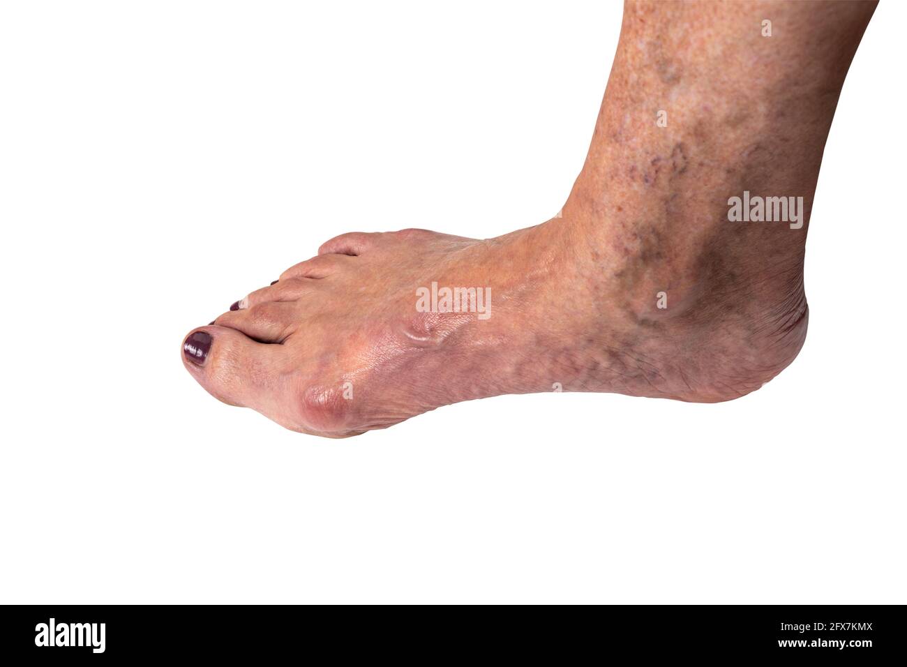 Human Foot Side View