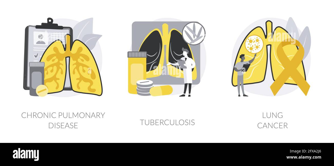 Lung issues abstract concept vector illustrations Stock Vector Image ...