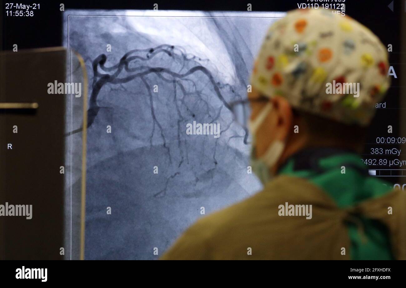 Coronary Angiography High Resolution Stock Photography and Images - Alamy