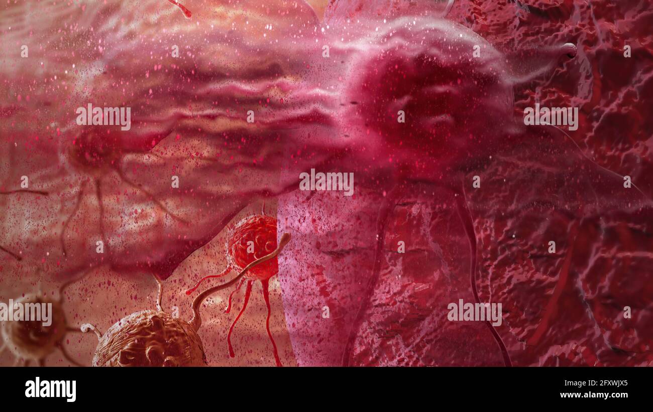 3d illustration of a damaged and disintegrating cancer cell Stock Photo ...